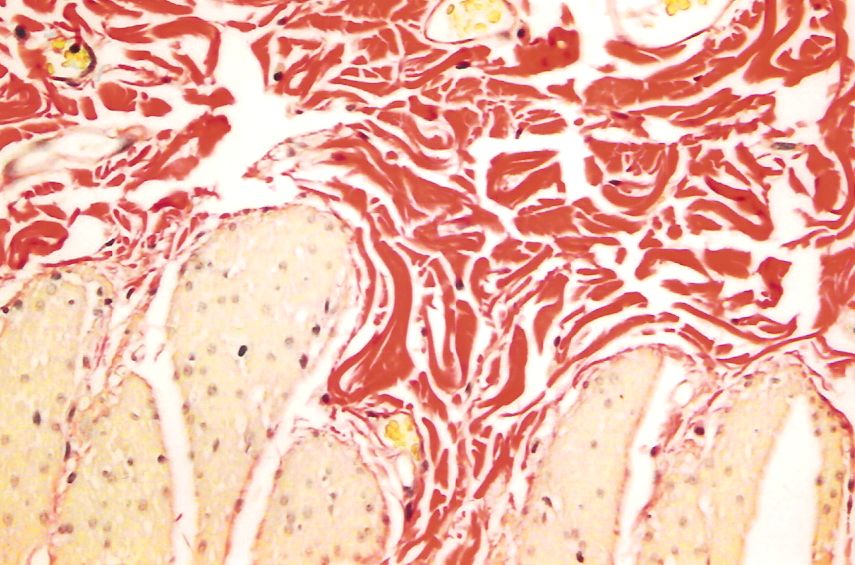 Fibrin Weigert Stain Method